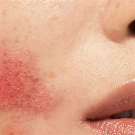 Raudonis Ir Rožinė Aum Wellness Clinic