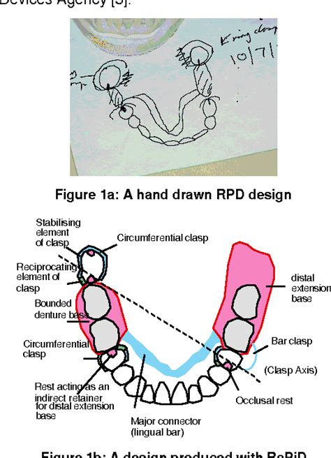 Rpd Design Drawing Design Talk