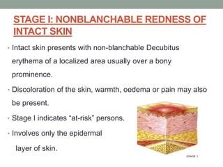 Decubetic Ulcer Bed Sorespptx Skin And Dermatology Diseases And