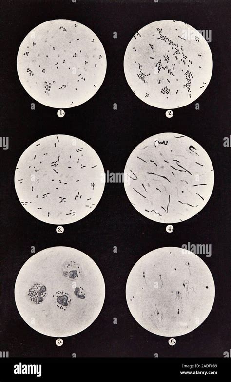 Leptospirosis Research By Sanarelli 19th Century Illustration Of
