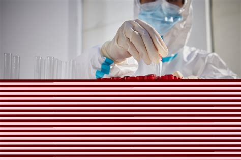 技术丨pcr Qpcr空白对照总有假阳性？别再忽视气溶胶污染 企业动态 丁香通