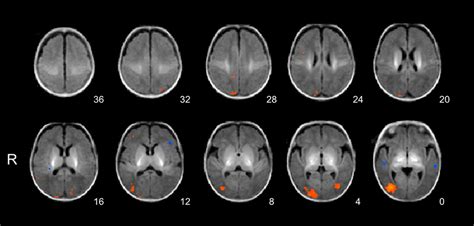 Brain Activity Map Reveals How Infant Vision Develops In The 7 Week Old Cortex
