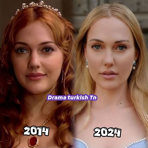 الممثلة التركية مريم أوزرلي بعد مرور Drama Turkish Tn