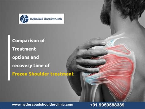 Frozen Shoulder Duration At Barbara Macdonald Blog