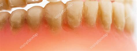 Plaque Dentaire Ou Plaque Bactérienne — Conseil Dentaire Drhauteville