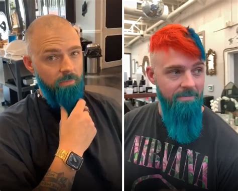 Balding Guys Try Out Non Surgical Hair Replacements By Phil Ring And