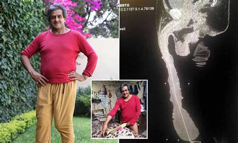The Man Who Stunned The World With His 19 Inch Penis Only To Be
