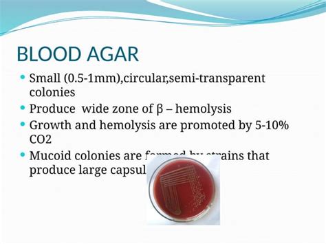 Streptococcus Pyogenes Introduction Classification Ppt