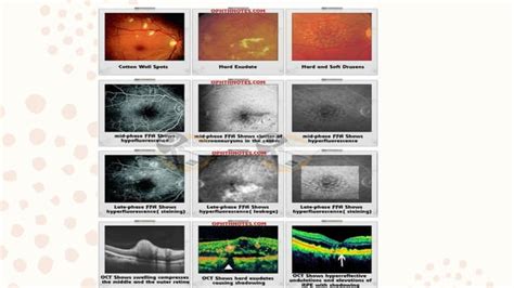 Macular Function Test Ppt