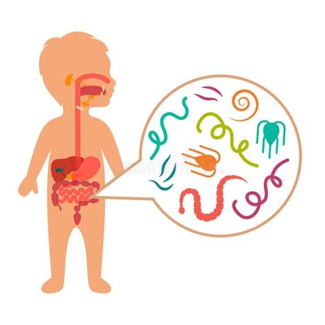 Ilustrarea Vectorială A Unei Boli A Paraziților Intestinali Ai Unui Copil Stock Vector