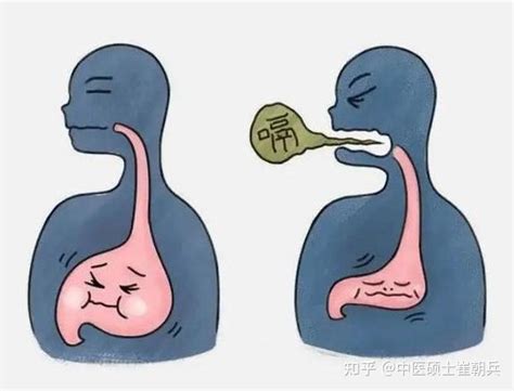 注意固护脾胃，小心胃气上逆！ 知乎