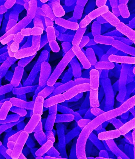Nocardia Sp Gram Positive Photograph By Science Photo Library Pixels