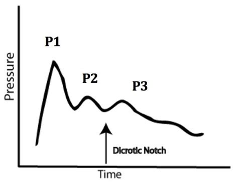 Icp And Evd Exam 3 Flashcards Quizlet