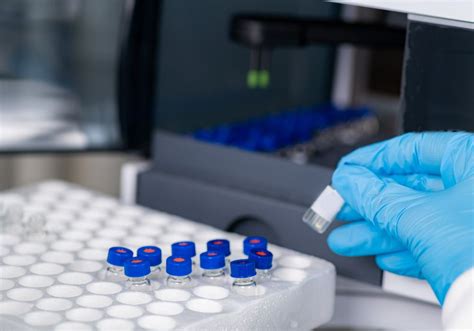 Imaged Cief Ce Sds And Imaged Cief Fractionation