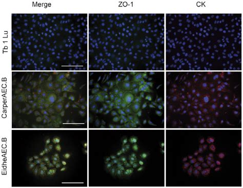 Immunofluorescence Staining For Markers Of Epithelial Origin Of Tb 1 Lu