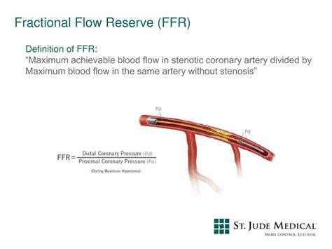 Ppt Ffr And Pressurewire ™ Certus Powerpoint Presentation Free