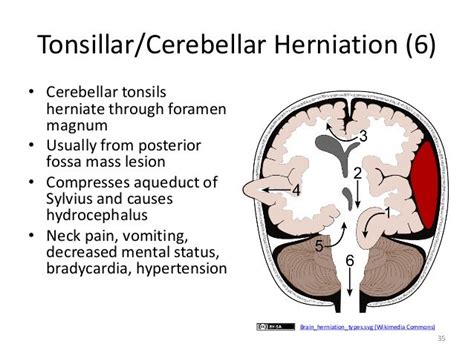 Gemc Pediatric Neurologic Emergencies Resident Training