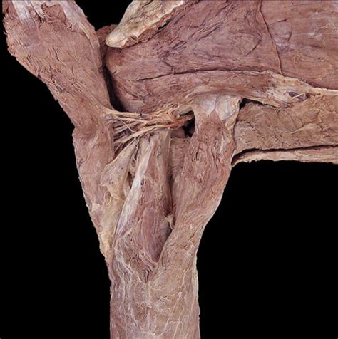 Cadaver Anatomy Quadrangular Space Diagram Quizlet