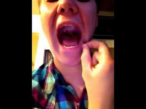 Longest Uvula In The World Youtube