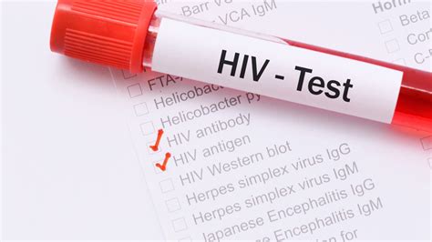 The Role Of Hiv Testing In Preventing Transmission Drsafehands