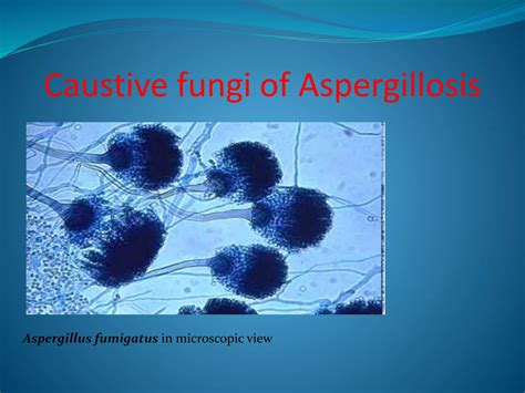 Aspergillosis Pptx