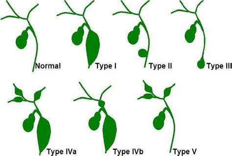 Todani Classification Of Target Ini Cet Mdms