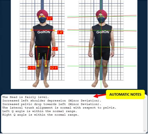Portable Posture Analysis System Gaiton At Best Price In New Delhi