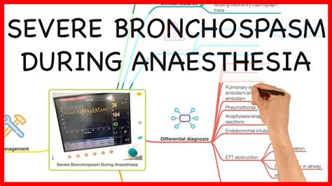Severe Bronchospasm During Anaesthesia Practical Conduct Series Youtube