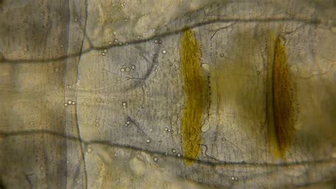 140 Insect Under The Microscope Stock Videos And Royalty Free Footage