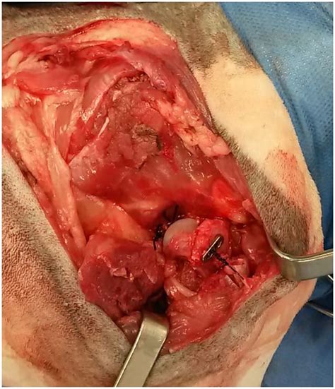 Long Term Outcome After Total Scapulectomy For The Treatment Of Osteosarcoma In A Cat