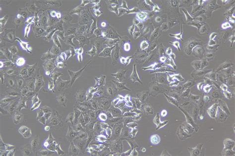 过表达细胞稳转株 艾迪基因