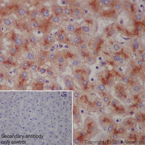 Lamp2抗体 Epr19531 Lysosome Marker Ab199947 Abcam中文官网