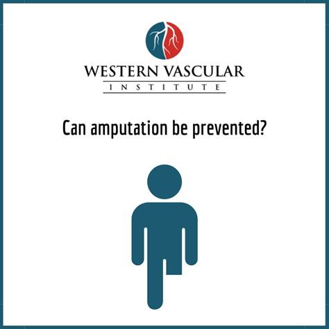 Amputation Prevention