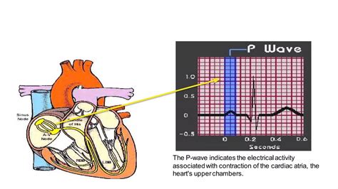 Ecg Presentation Ppt