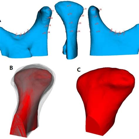 A 25 Landmark Registration For Surface Model Approximation B