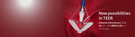 Pascal Precision システム Edwards Lifesciences