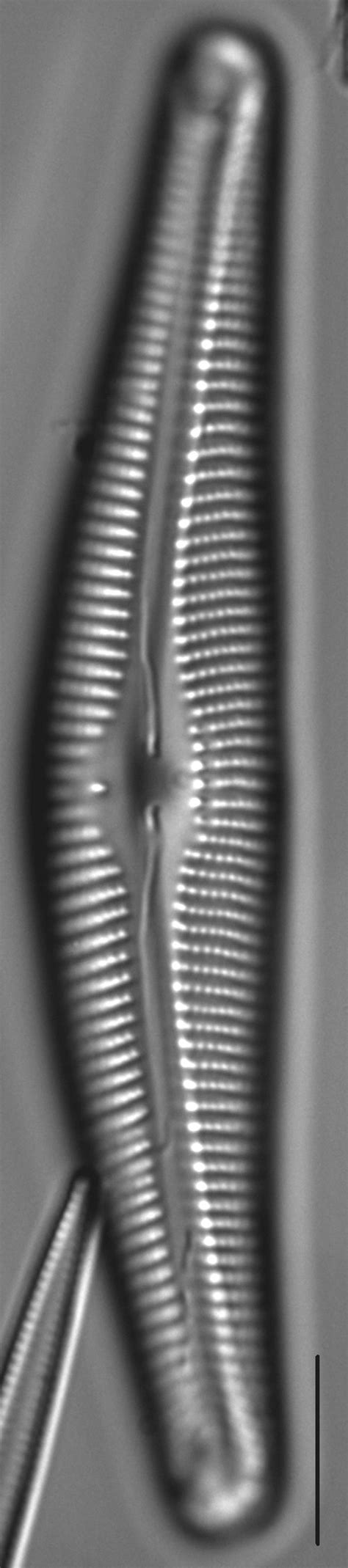 Image Cymbella Lange Bertalotii1  Species Diatoms Of North America