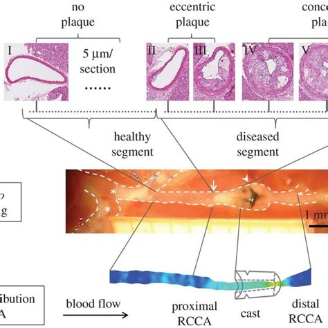 spatial matching of histological sections to three dimensional wss map