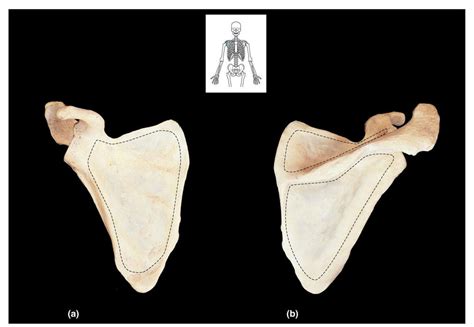 Scapula Bone Markings Diagram Quizlet