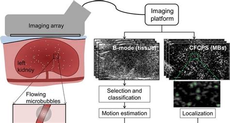 Ultrasound Localization Microscopy To Image And Assess Microvasculature