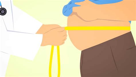 Tipos De Obesidad Control De Peso Y Obesidad Salud