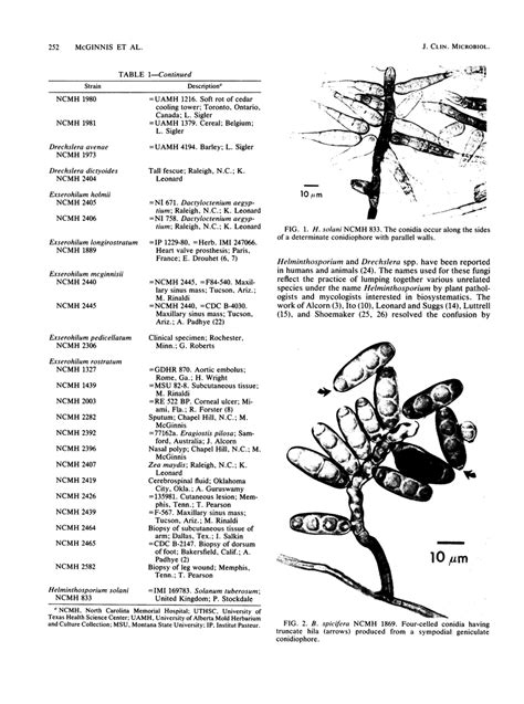 Emerging Agents Of Phaeohyphomycosis Pathogenic Species Of Bipolaris And Exserohilum Pmc