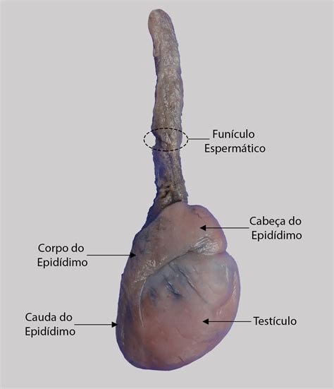 Onde Fica O Epidídimo Retoedu