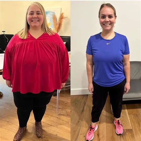 How To Burn Huge Belly In Three Months Only Before And After Fat Loss