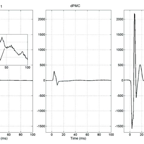 Typical Waveforms After Stimulating The Motor Cortex M1 Dorsal