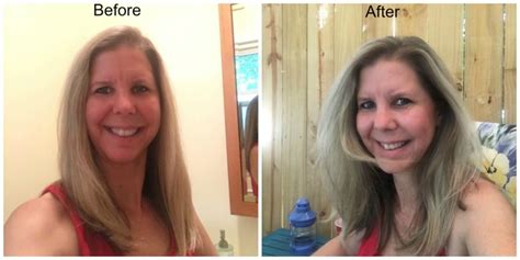 Nioxin Shampoo Review Does It Work