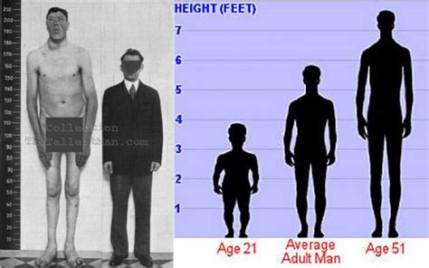 The Life Of Adam Rainer From Dwarfism To Gigantism Humans