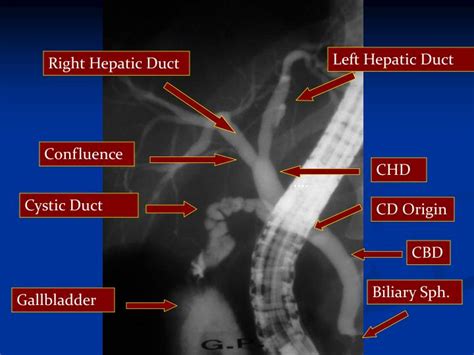 Ppt Ercp And Fluoro Quiz Powerpoint Presentation Id6818168