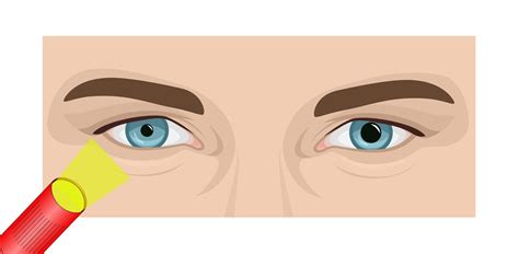 Pupil Assessment Wildmedkits