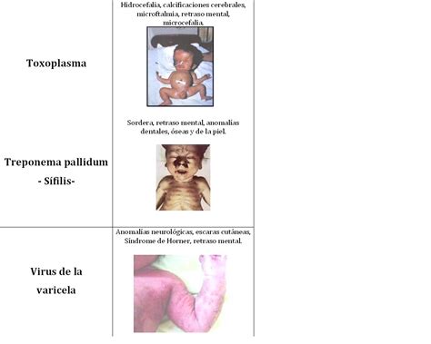 Asesorías Embriología Humana Teratogenos